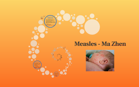 Measles - Ma Zhen by Jacqueline Haenschke on Prezi