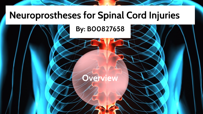 Neuroprostheses for Spinal Cord by Sarah Webb