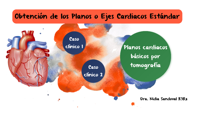 Semana 4 - Obtención de los Planos o Ejes Cardiacos Estándar by Nidia ...