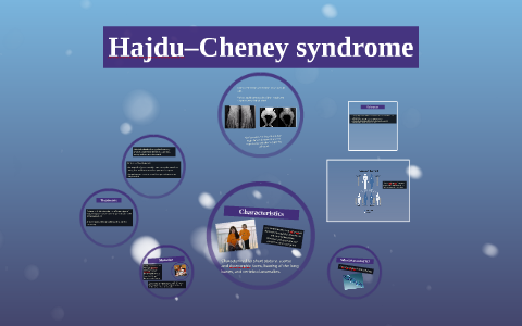 Hajdu–Cheney syndrome by Kyle Gibbs on Prezi