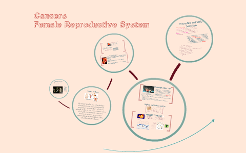 Cancers of the Female Reproductive System by Jenni V on Prezi