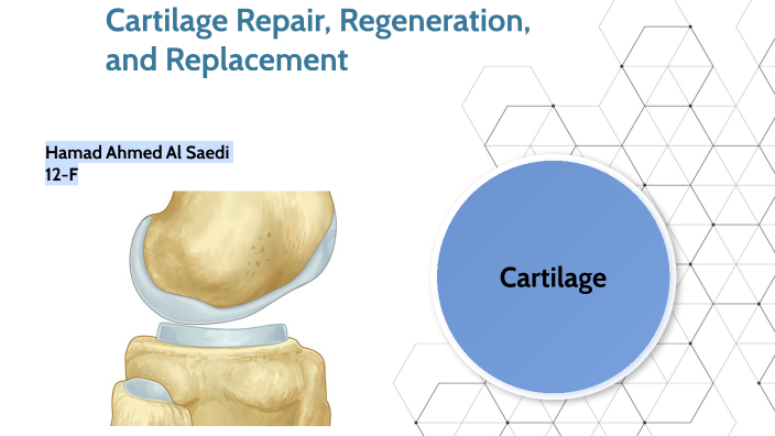 Cartilage Repair, Regeneration, and Replacement by mlkm ln on Prezi