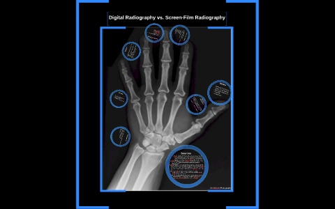 Digital Radiography vs. Screen-Film Radiography by Jessica Bintliff on ...