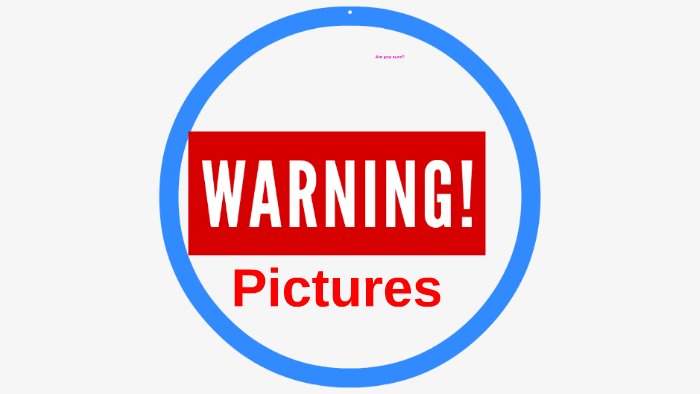 Journey of Smallpox by Destiny Ramsey