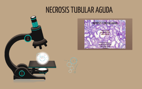 NECROSIS TUBULAR AGUDA by katerin renteria on Prezi