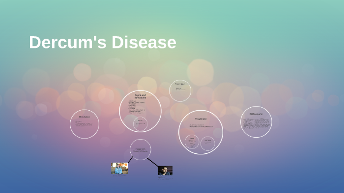Dercum's Disease by Jacob Oesterle on Prezi
