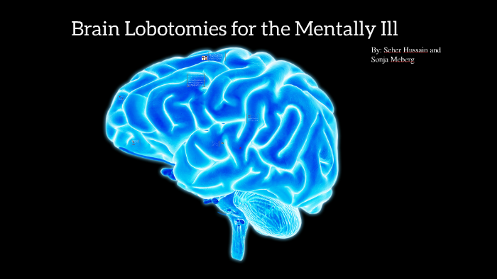 Mentally Challenged Brain