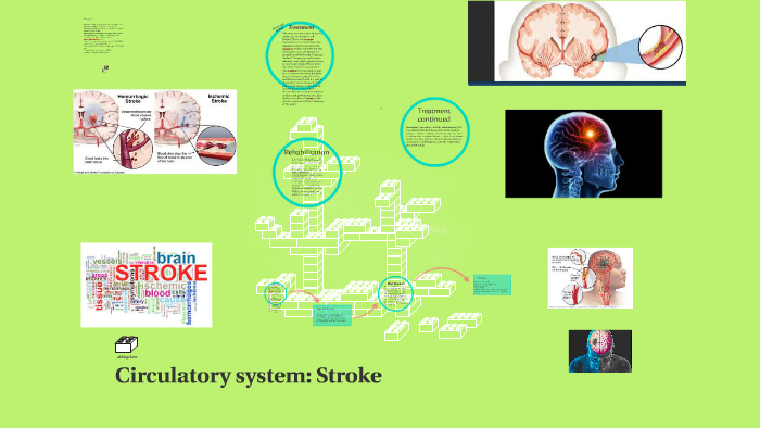 Circulatory system: Stroke by robert n on Prezi