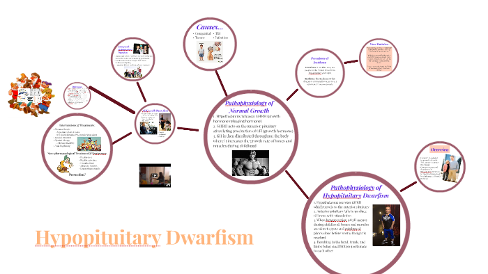 Hypopituitary Dwarfism by Taylor Blossom on Prezi