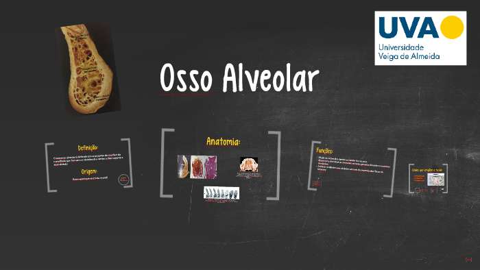 Osso Alveolar by Ramon Souza on Prezi