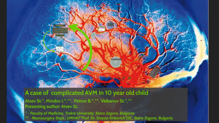 A case of complicated AVM in 10 year old child by Ivan Mindov on Prezi
