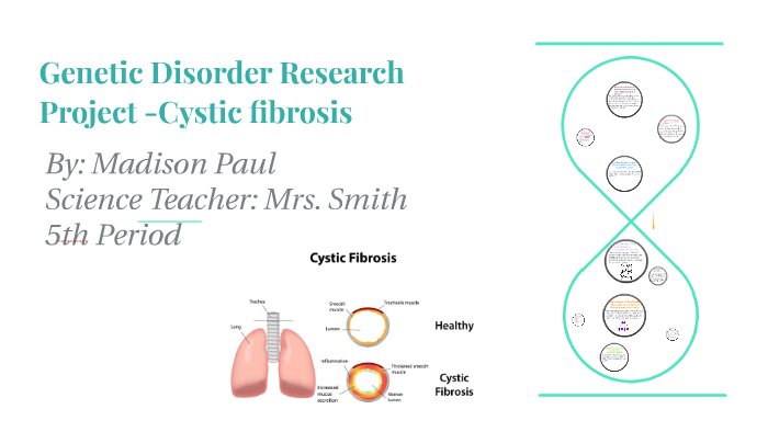 Genetic Disorder Research Project by Madison paul on Prezi
