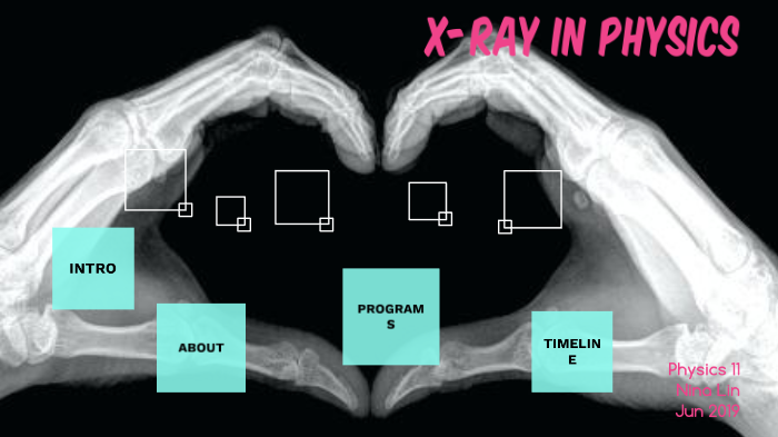 Physics project - X-ray by nina lin on Prezi