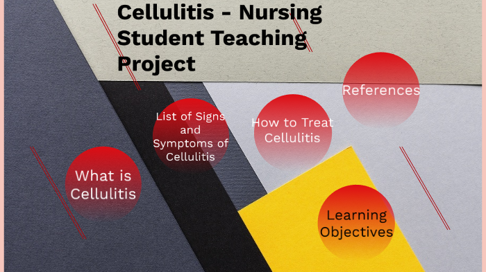 Cellulitis - Nursing Student Teaching Project by Joel Bell on Prezi