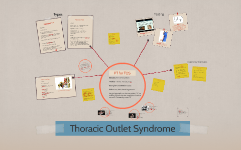 Thoracic Outlet Syndrome by Matthew Huson on Prezi