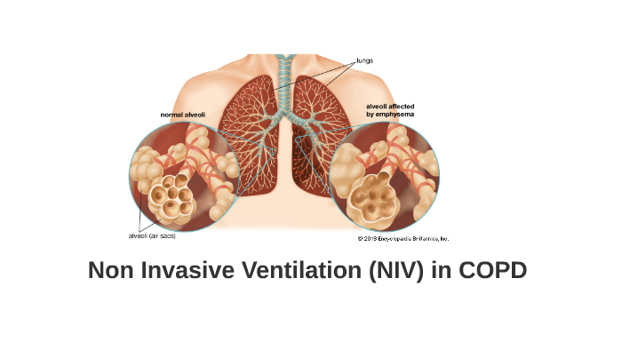 Non Invasive Ventilation (NIV) in COPD by gabrielle reiger on Prezi