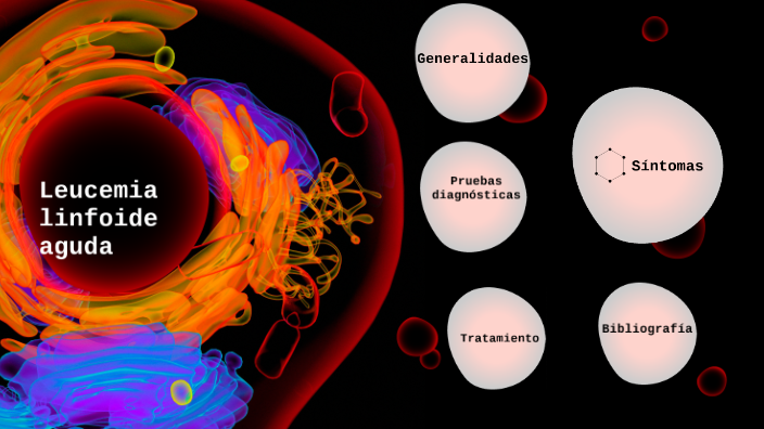Leucemia linfoide aguda by juan hernadez gomez on Prezi