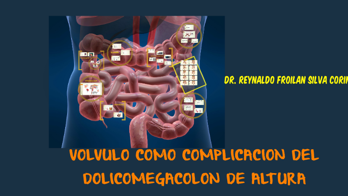 VOLVULO COMO COMPLICACION DE DOLICOCOLON DE ALTURA by Aneiva Perez on Prezi