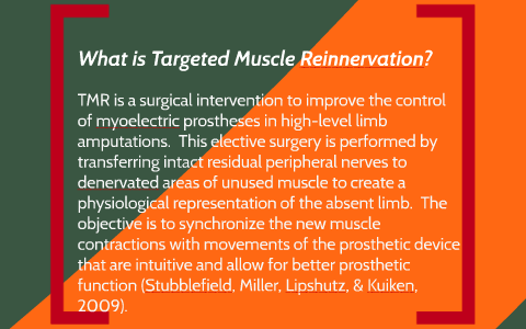 Targeted Muscle Reinnervation (TMR) by Matthew Kilian on Prezi