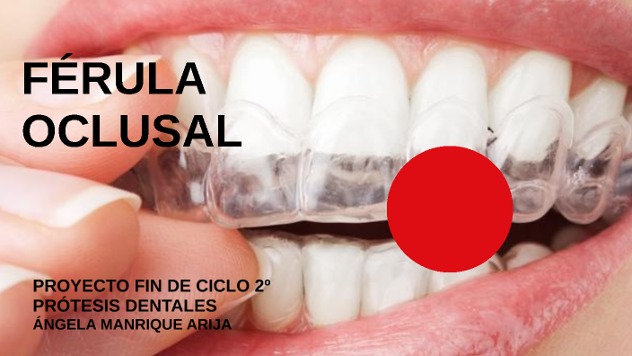 FÉRULA OCLUSAL by ANGELA MANRIQUE ARIJA on Prezi