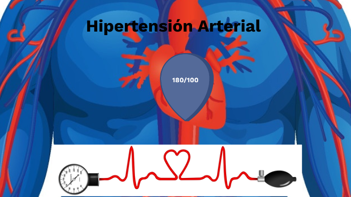 Hipertension Arterial By Luis Izaguirre Dominguez On Prezi