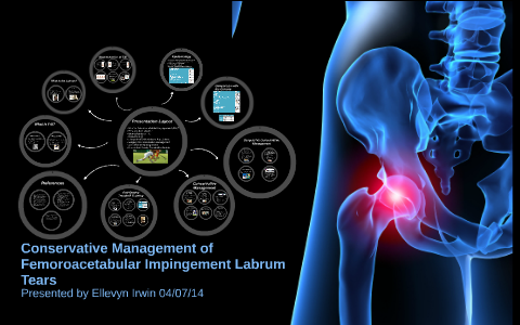 Conservative Management of Femoroacetabular Impingement Labr by Ellevyn ...