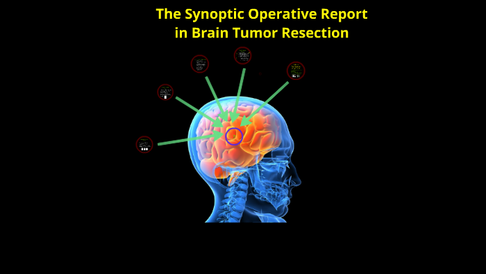 Synoptic Operative Report in Brain Tumor Surgery by Andrew Lee on Prezi