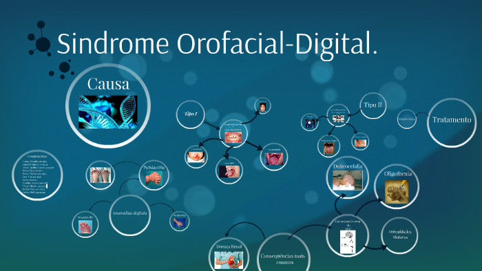Sindrome Orofacial-Digital. by Carine Donola on Prezi