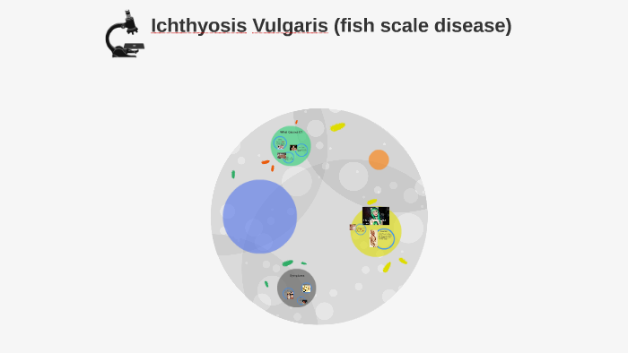 Ichthyosis Vulgaris (fish scale disease) by Ember Sommer on Prezi