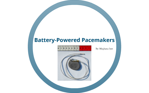 Battery-Powered Pacemakers by Meghana Iyer on Prezi