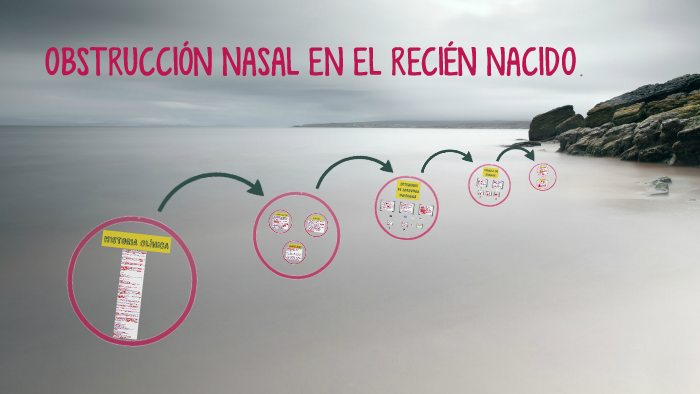 OBSTRUCCIÓN NASAL EN EL RECIÉN NACIDO by Andrés Martinoni on Prezi