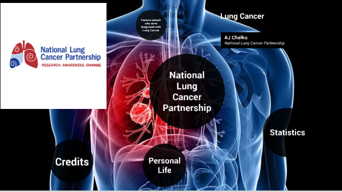 Lung Cancer Project by AJ Chelko on Prezi
