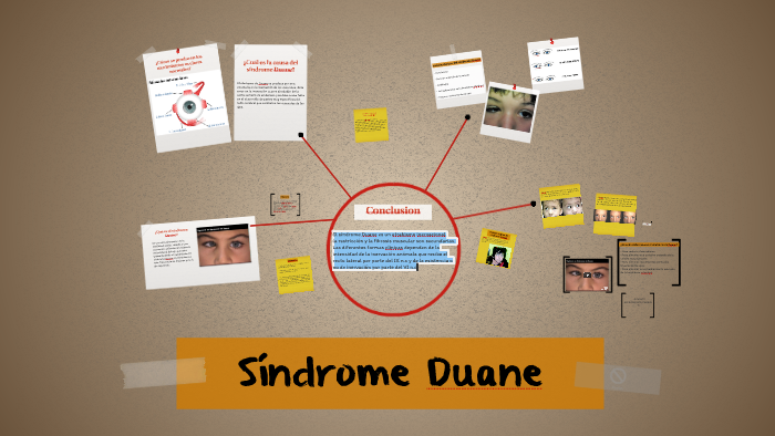 Síndrome de Duane by Briseyda Juárez on Prezi