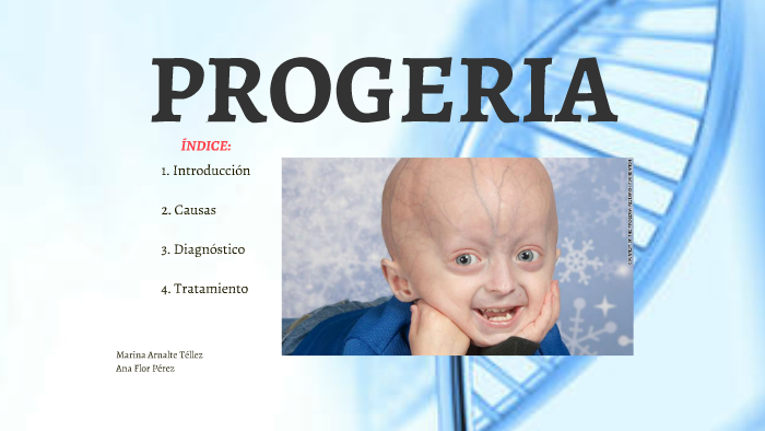 PROGERIA by on Prezi