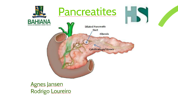 Pancreatites by Rodrigo Machado on Prezi