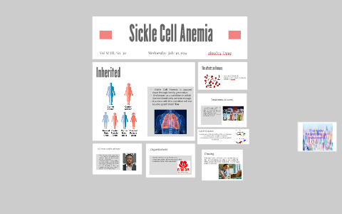 sickle cell anemia by Esme Reyes on Prezi
