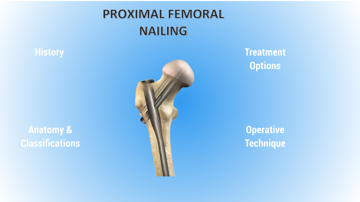 Proximal Femoral Nailing by Joshua Parslow on Prezi