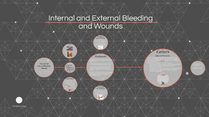 Internal and External Bleeding/Wounds by Ben Watts on Prezi