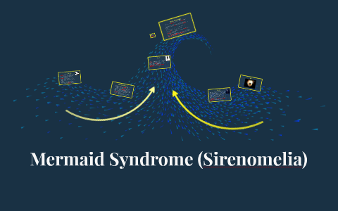 Mermaid Syndrome (Sirenomelia) by Aliyah Wiggins on Prezi