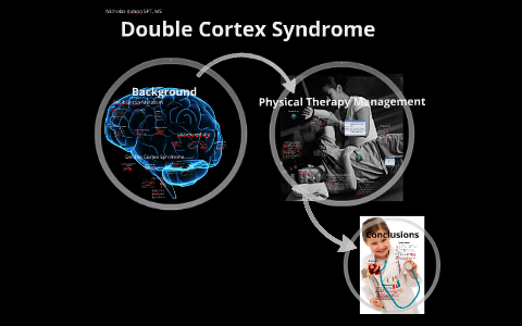 Double Cortex Syndrome by Nicholas Kulesa on Prezi