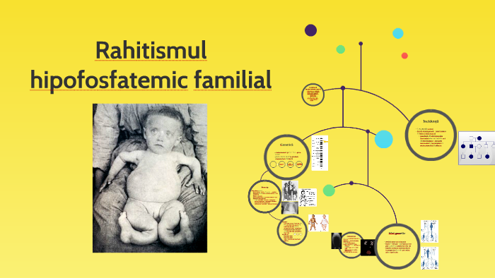 Rahitismul hipofosfatemic familial by Catalina Radu on Prezi