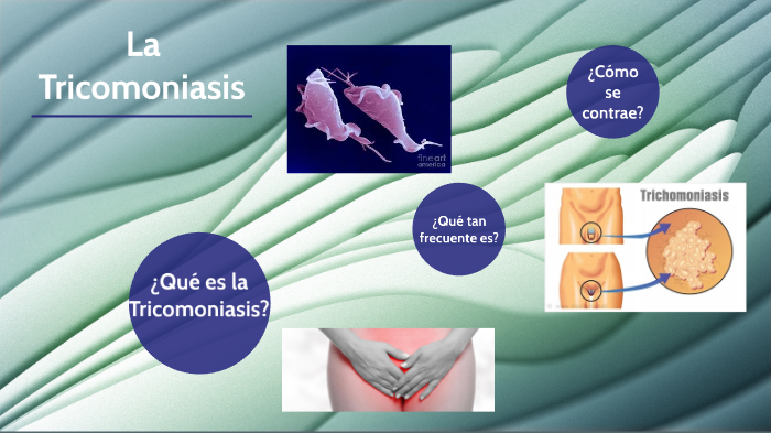 La Tricomoniasis by Anthony Poma Torrejon on Prezi