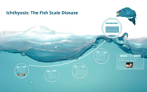 Ichthyosis: The Fish Scale Disease by Tristan Diep on Prezi