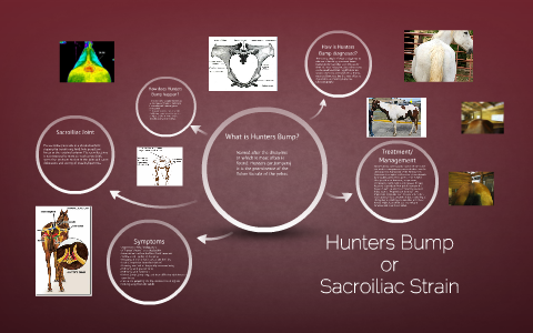 Hunters Bump or Sacroiliac Strain by Rebekah Ovitt on Prezi