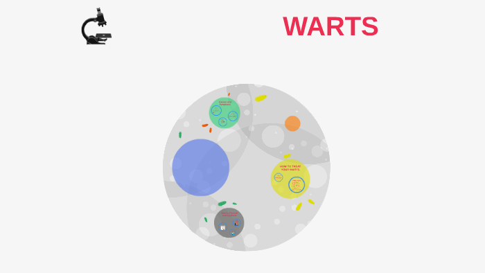 WARTS by Landon Timmons on Prezi