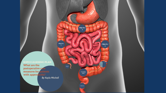 Learning Plan: Appendicitis by Kayla Mackenzie Mitchell on Prezi