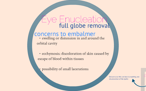 embalming for tissue and organ donors!! by Arianna Ervin on Prezi