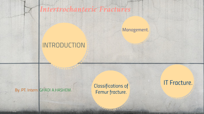Intertrochanteric Fracture. by Ghadi Hashem on Prezi