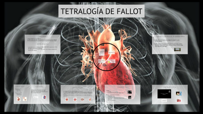 TETRALOGÍA DE FALLOT by María del Mar Navarro García on Prezi