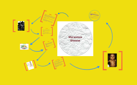 Marasmus Disease by Jared McFadden on Prezi